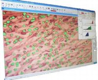BAB Microscopy & Image processing and analysis system